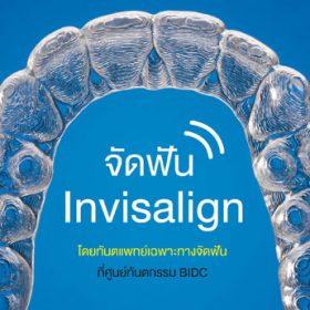 จัดฟันใส invisalign ดียังไง? ทำไมดาราถึงนิยมทำในปัจจุบัน | BIDC