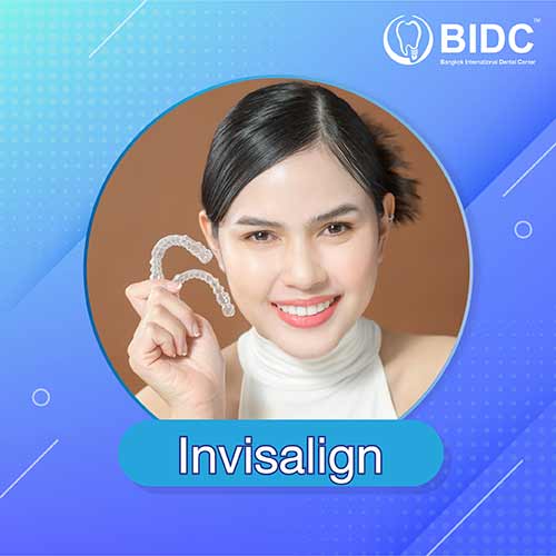 จัดฟันใส Invisalign VS วีเนียร์ เลือกทำฟันสวยแบบไหนดี ? | BIDC